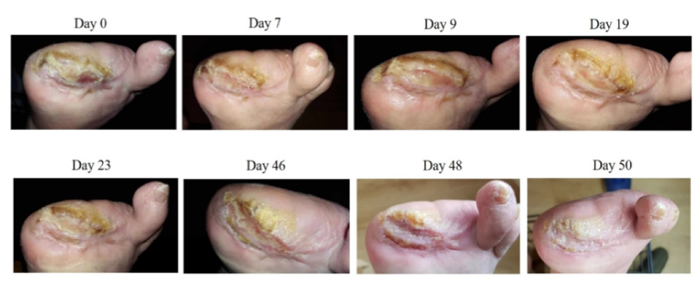 Wound Healing and Regeneration – Credible Biotech