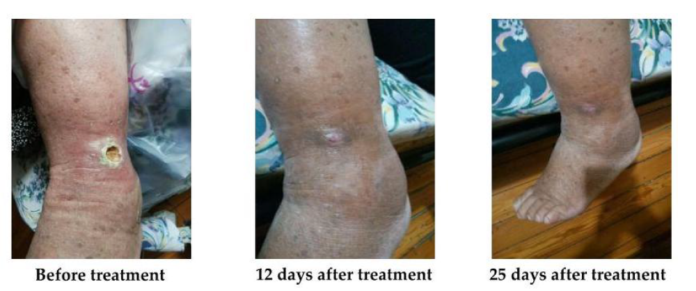 Wound Healing and Regeneration – Credible Biotech